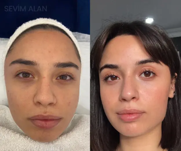 Sevim Alan - Sevim Alan - Güzellik Merkezleri