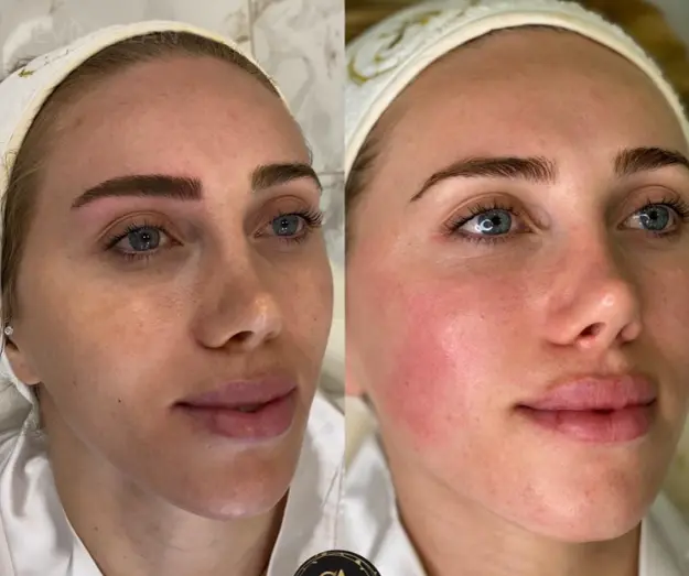 Sevim Alan - Sevim Alan - Güzellik Merkezleri